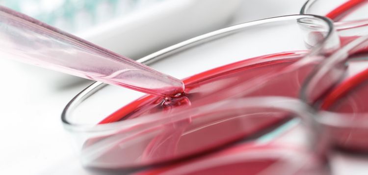 Inline monitoring of cell cultures with Raman spectroscopy | Metrohm